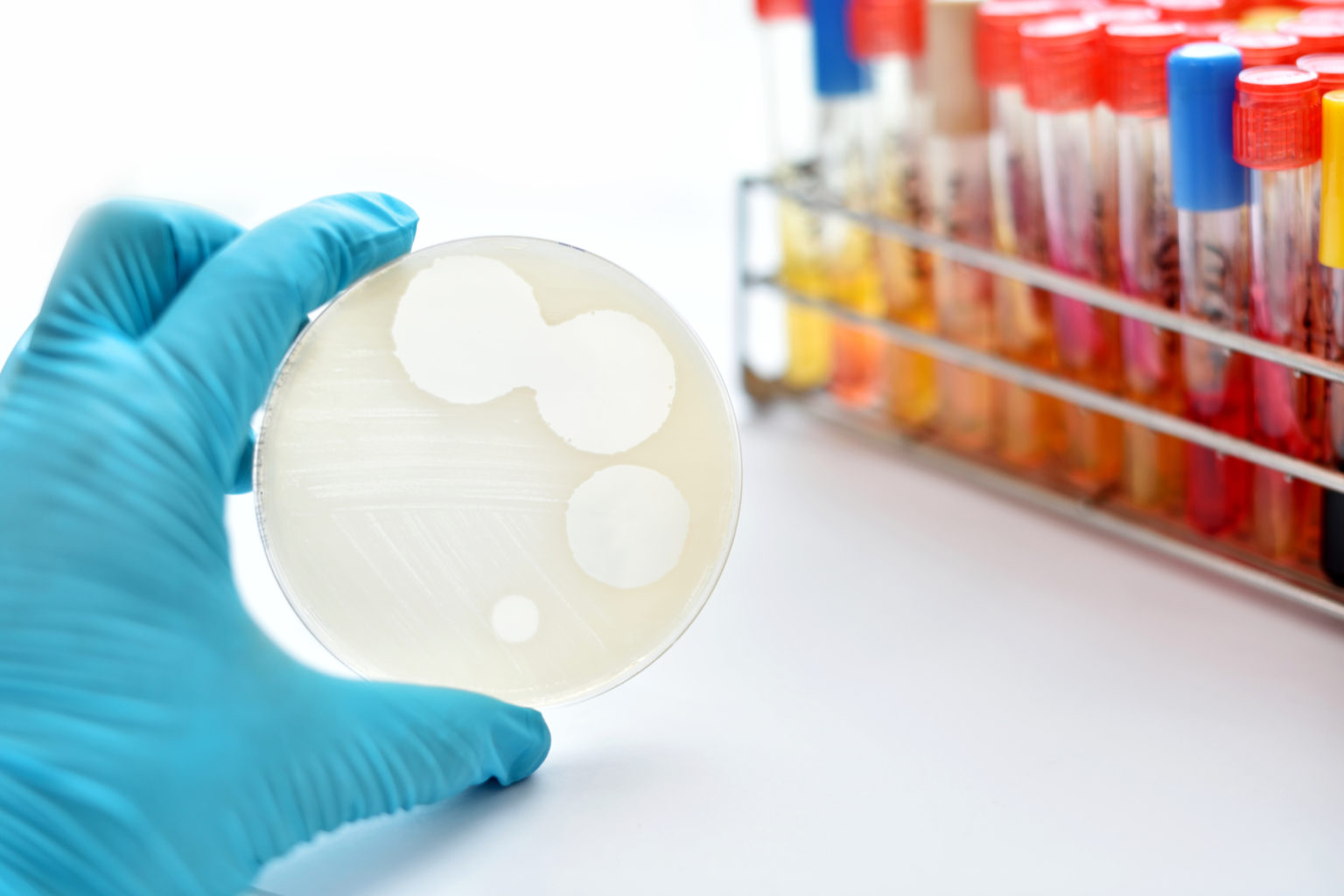 Antimicrobials, Evolving for Modern Consumerism - Wenda Ingredients